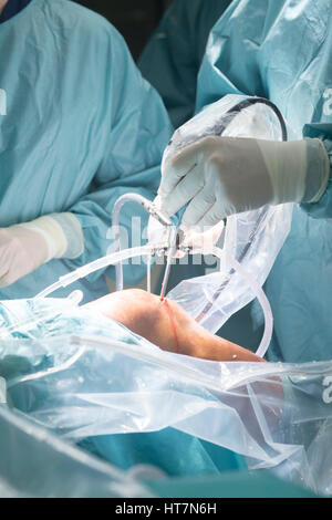 Knee keyhole surgery hospital arthroscopy operation medical procedure ...