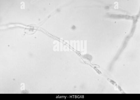 Algae Prototheca filamenta, which resembles a fungal organism due to ...