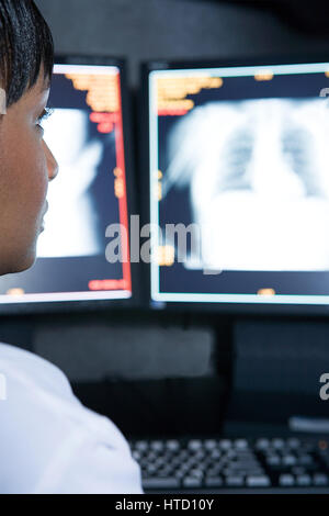 Doctor examining chest X-rays with digital tablet Stock Photo - Alamy