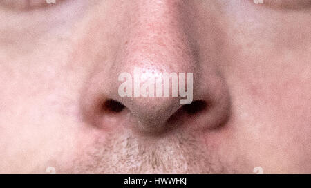 Munich, Germany. 15th Mar, 2017. A combo showing the noses of men of ...