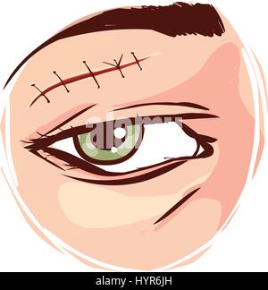 surgery suture cartoon vector illustration Stock Vector Image & Art - Alamy