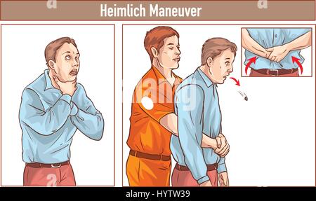 vector illustration of a Heimlich maneuver on oneself Stock Vector ...