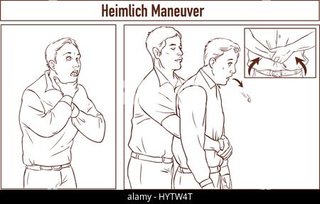 vector illustration of a Heimlich maneuver on oneself Stock Vector ...