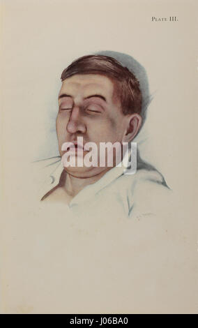 'An Atlas of Gas Poisoning' by the American Red Cross and Medical ...