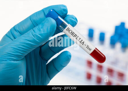 Lyme Disease Test tube with blood sample in infection lab Stock Photo ...