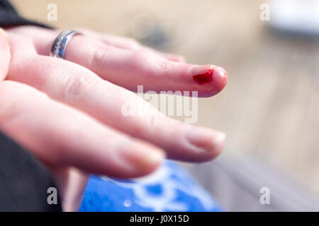 Close up of woman's hand with bleeding finger nail injury Model Release ...