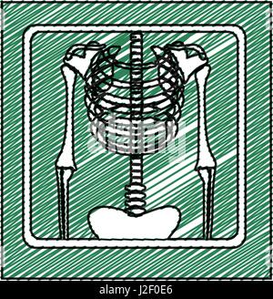 color pencil drawing of symbol of chest radiography Stock Vector Image ...