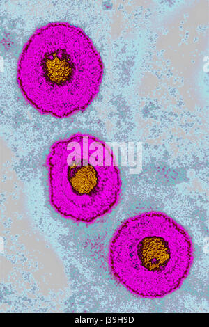 HERPES SIMPLEX VIRUS TYPE 2 Stock Photo - Alamy