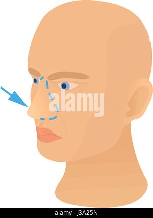 Wrinkle nose icon cartoon vector. Plastic operation. Face operation ...