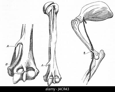 Supracondyloid ligament and feline foramen Stock Photo - Alamy