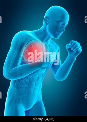 Anatomy of person coughing, illustration Stock Photo - Alamy