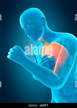 Anatomy of person coughing, illustration Stock Photo - Alamy