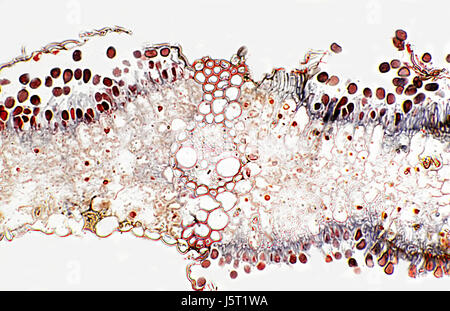 Black Stem Rust (Puccinia graminis), Fungi, LM Stock Photo - Alamy