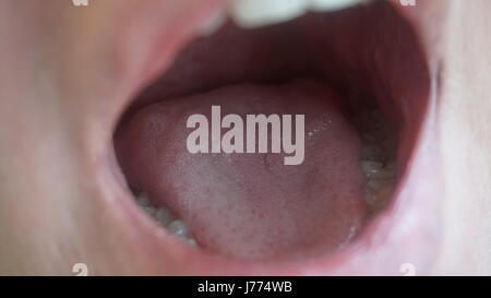 Bad teeth of a guy. Rotten and yellow teeth Stock Photo - Alamy