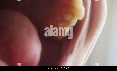 Bad teeth of a guy. Rotten and yellow teeth Stock Photo - Alamy