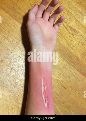 Fake Injury Cosmetic Stage Makeup Stock Photo - Alamy