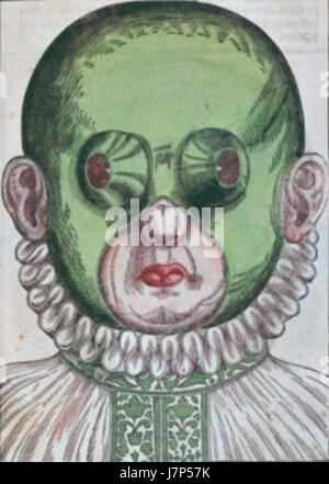 The 16th century illustration of surgery and surgical operations in the ...