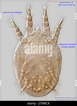 1-Sancassania boharti HDN dors DIC40 BMOC 96-0916-059 Stock Photo - Alamy