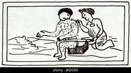 Measles Aztec drawing Stock Photo - Alamy