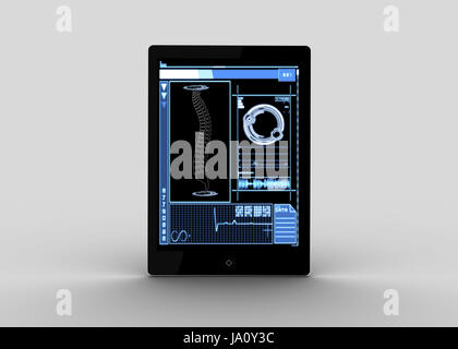 Tablet showing medical spine interface Stock Photo - Alamy