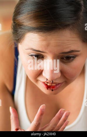 Wound nosebleed, woman bleeding from her nose, nose injury blood and ...