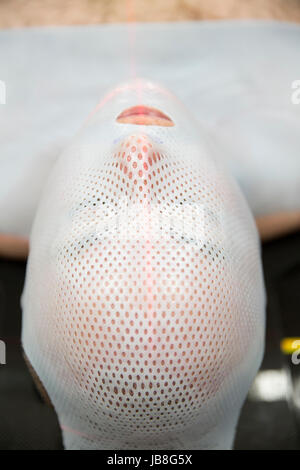 making a radiotherapy face mask Stock Photo - Alamy