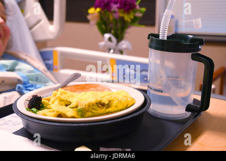 Patients food (omelette) on tray in NHS hospital. England, UK Stock ...