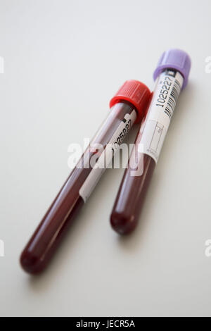 Laboratory, test tube, blood, medicine, hospital, blood bank Stock ...