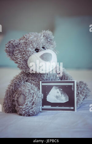Teddy bear with ultrasound scan of baby and stethoscope on white ...