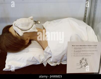 A display depicting the use of chloroform inhalers, at the Surgical ...