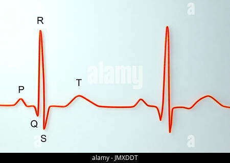 ECG. Computer artwork of an electrocardiogram (ECG) showing a normal ...