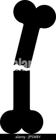 Painted broken bone, vector illustration Stock Vector Image & Art - Alamy