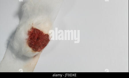 human blood on cotton wool sponge ball on white background. Blood ...