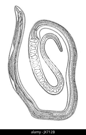 Trichosomoides crassicauda drawing in Hall 1916 Stock Photo - Alamy