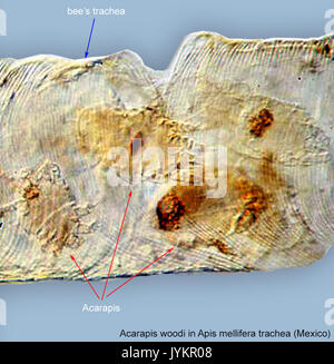 Acarapis woodi in in Apis mellifera trachea 28505 Tracheal Mite USDA ...