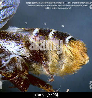 4 Sancassania Ctenocolletes albomarginatus tergal acarinarim with ...