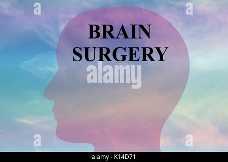 Render illustration of "HEAD SURGERY" title on head silhouette, with ...