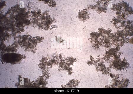 Magnified 128X, this photomicrograph revealed some of the ...