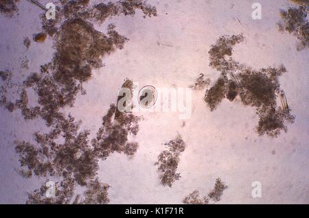 Magnified 128X, this photomicrograph revealed some of the ...
