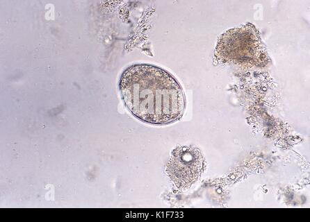 Under a high magnification of 400X, this photomicrograph revealed some ...