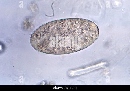 Under a high magnification of 400X, this photomicrograph revealed some ...