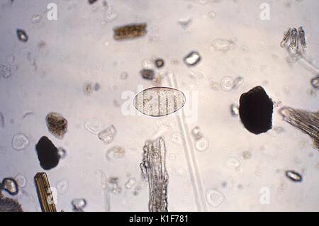 Magnified 128X this photomicrograph revealed the presence of two ...