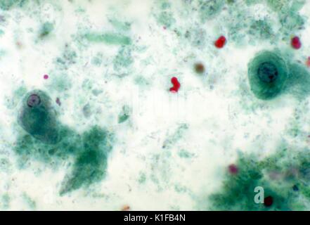 This photomicrograph depicts an Entamoeba histolytica parasitic trophozoite Stock Photo - Alamy