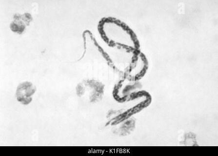 This photomicrograph depicts the Mansonella ozzardi microfilaria of ...