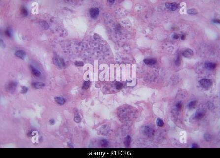 Leishmaniasis, light micrograph Stock Photo - Alamy