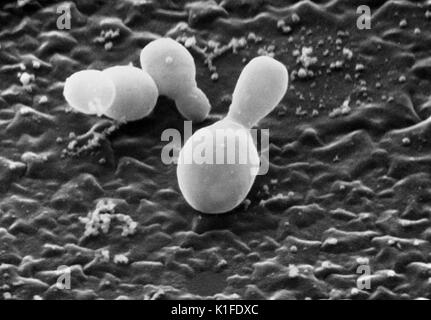 Scanning electron micrograph (SEM) of Malassezia furfur . Image ...