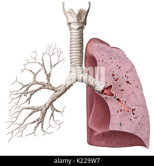 This image shows a cross section of the lungs, which reveals the main ...