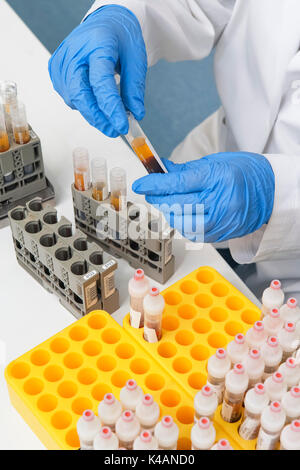 Blood samples for examination at the hospital Stock Photo - Alamy