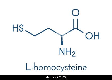 Chemical structure of homocysteine (Hcy) amino acid. Elevated blood ...