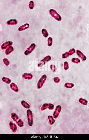 Yersinia pestis, Gram-negative bacillus, 1000x Magnification. Y Stock ...